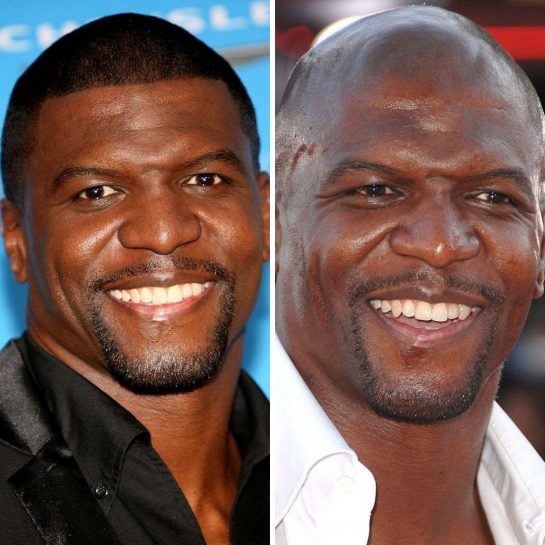 Here’s How These 15 Famous Bald Actors Looked Like When They Had Hair ...